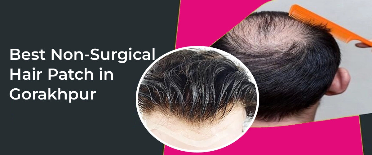 Best Non-Surgical Hair Patch in Gorakhpur | Ayub Hair Studio